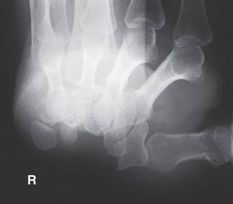 RX Polso: Quando l'età conta | LEG Srl Stp